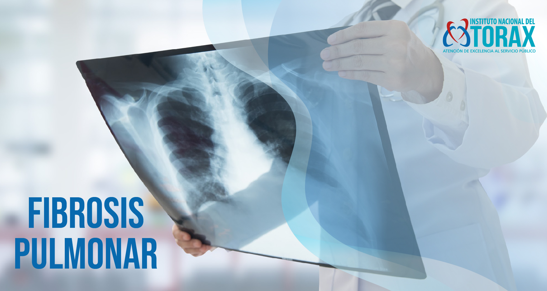 Conoce más sobre la Fibrosis Pulmonar – Instituto Nacional del TORAX